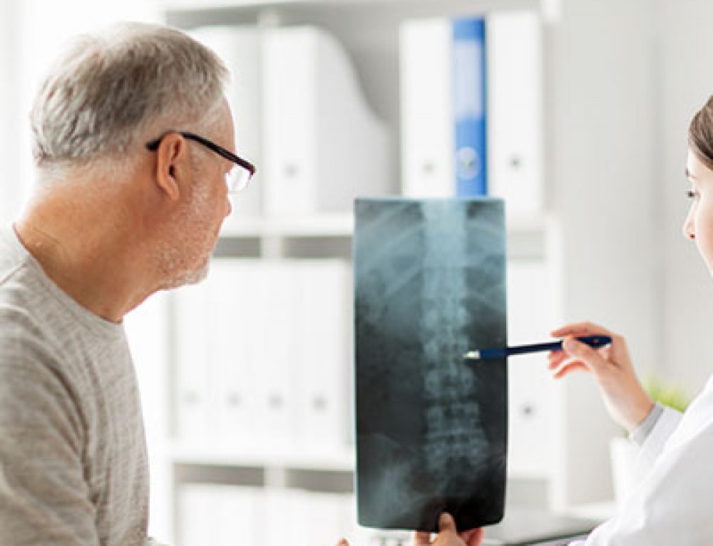 What Should My Lumbar Spine Look Like? | Murrells Inlet Chiropractor ...